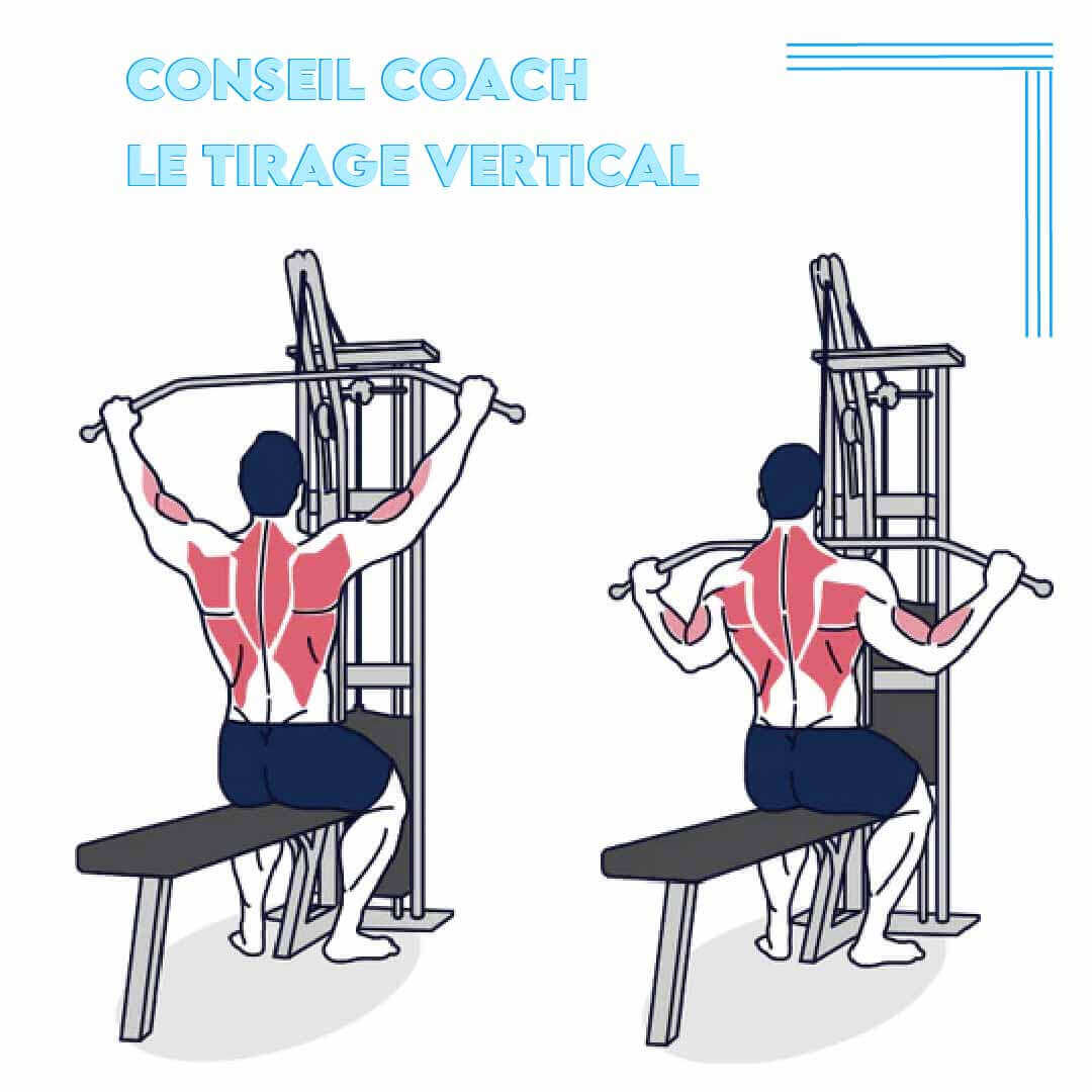 Le tirage vertical et ses variantes